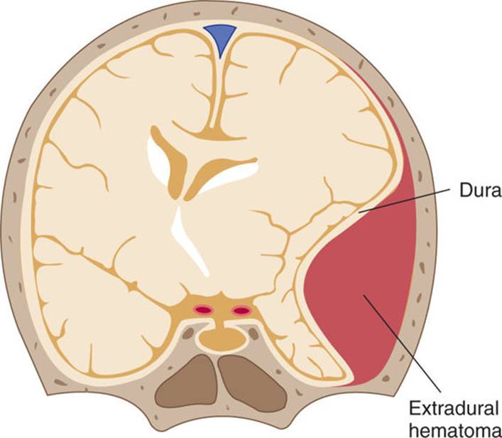 Vascular Supply of the Brain - Clinical Neuroanatomy, 28 ed.