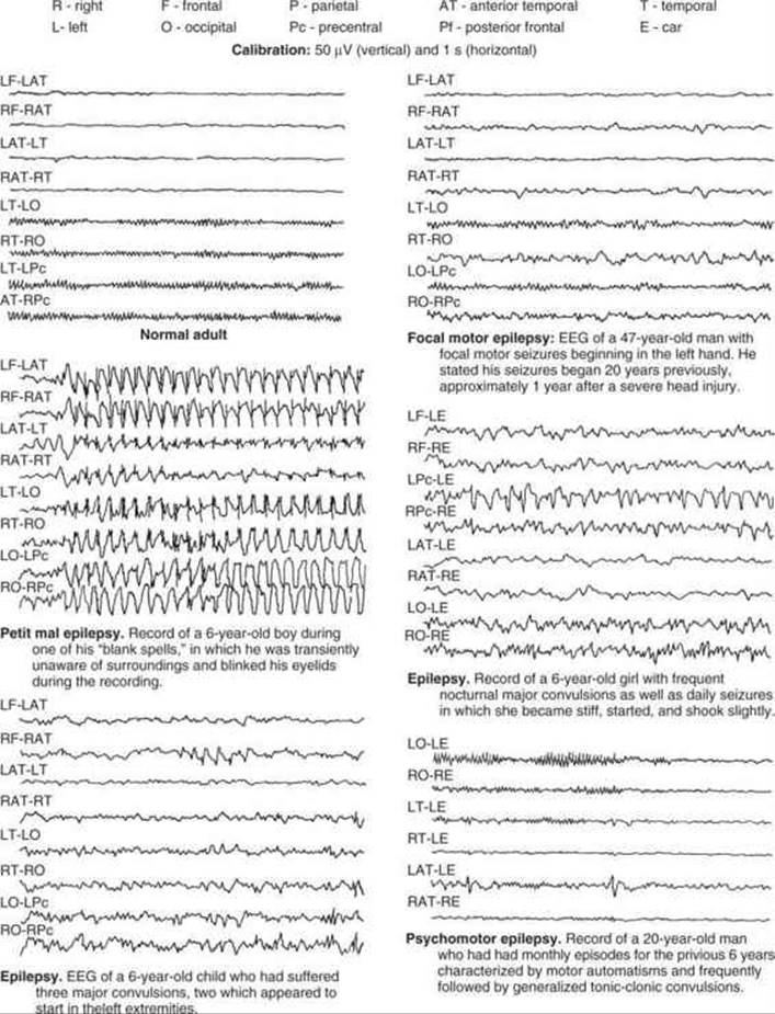 Electrodiagnostic Tests - Clinical Neuroanatomy, 28 ed.