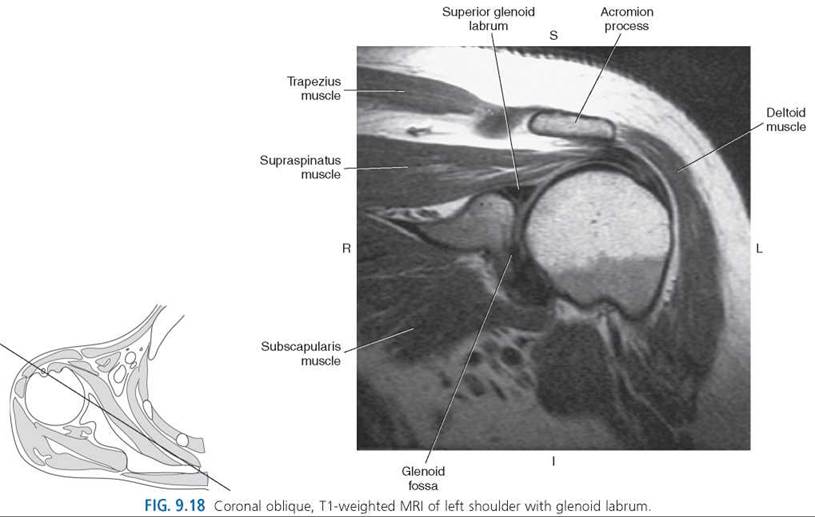 Upper Extremity - Sectional anatomy for imaging professionals, 4th edition