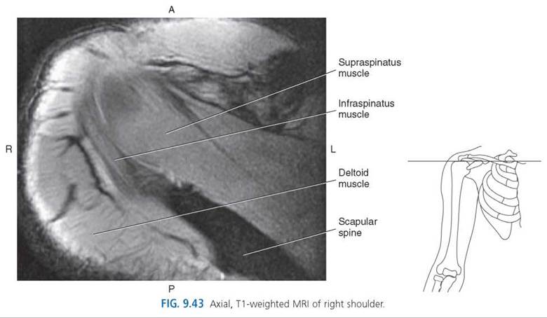 Upper Extremity - Sectional anatomy for imaging professionals, 4th edition