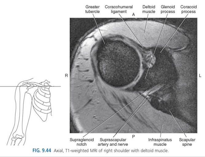 Upper Extremity - Sectional anatomy for imaging professionals, 4th edition