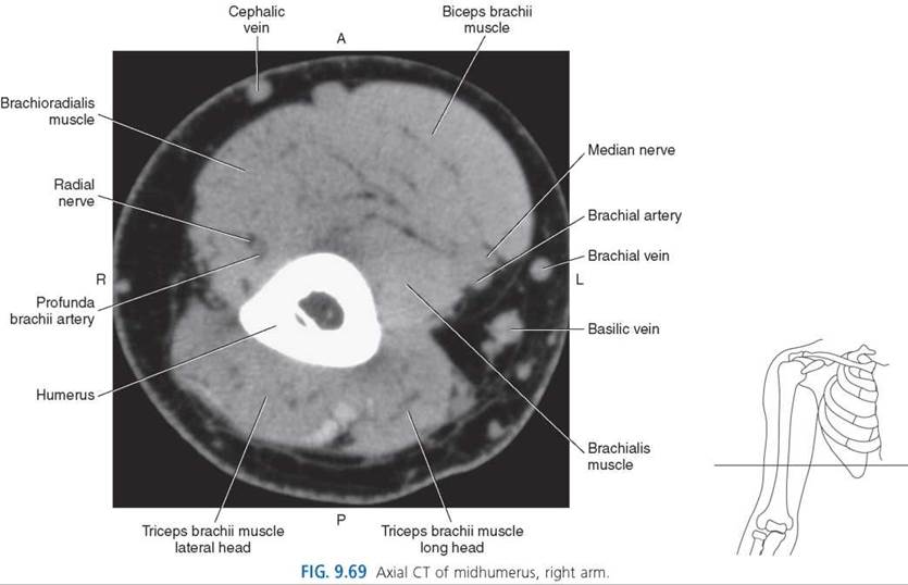 Upper Extremity - Sectional anatomy for imaging professionals, 4th edition