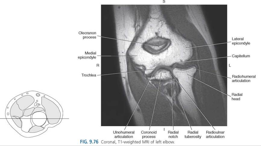 Upper Extremity - Sectional anatomy for imaging professionals, 4th edition