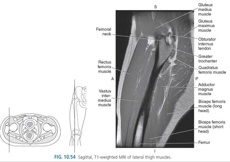 Lower Extremity - Sectional anatomy for imaging professionals, 4th edition