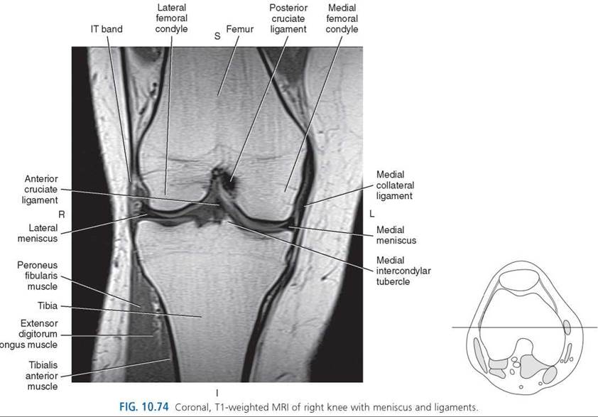 Lower Extremity - Sectional anatomy for imaging professionals, 4th edition