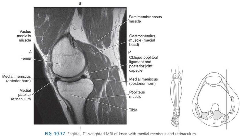 Lower Extremity Sectional Anatomy For Imaging Professionals 4th Edition