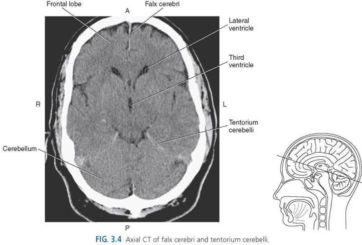 Brain - Sectional anatomy for imaging professionals, 4th edition