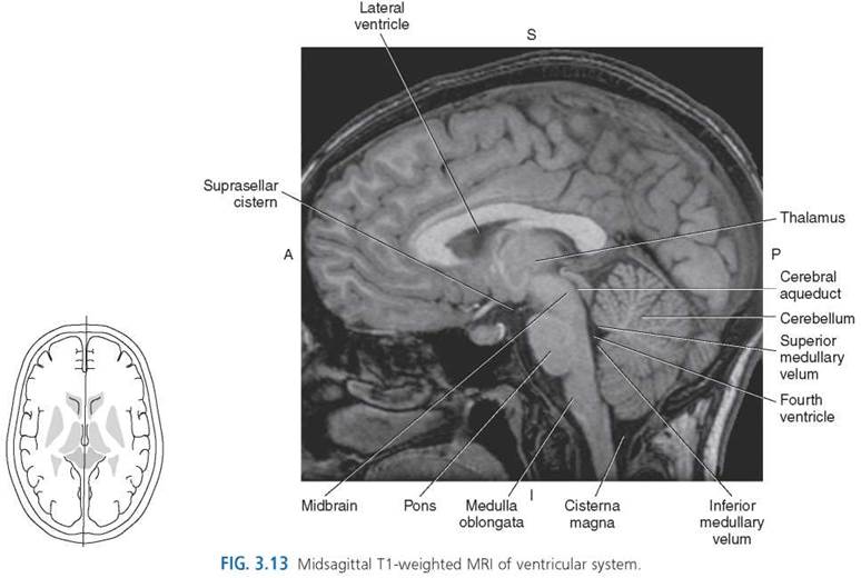 Brain - Sectional anatomy for imaging professionals, 4th edition