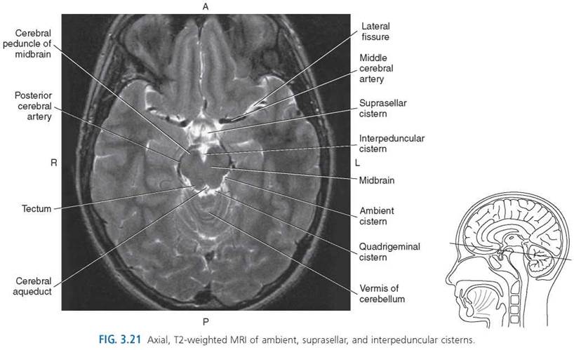Brain - Sectional anatomy for imaging professionals, 4th edition