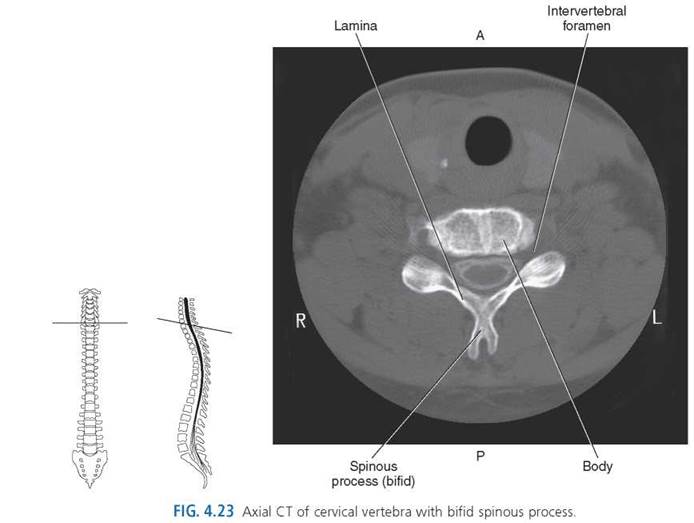 Spine - Sectional anatomy for imaging professionals, 4th edition