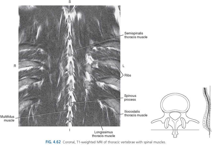 Spine - Sectional anatomy for imaging professionals, 4th edition