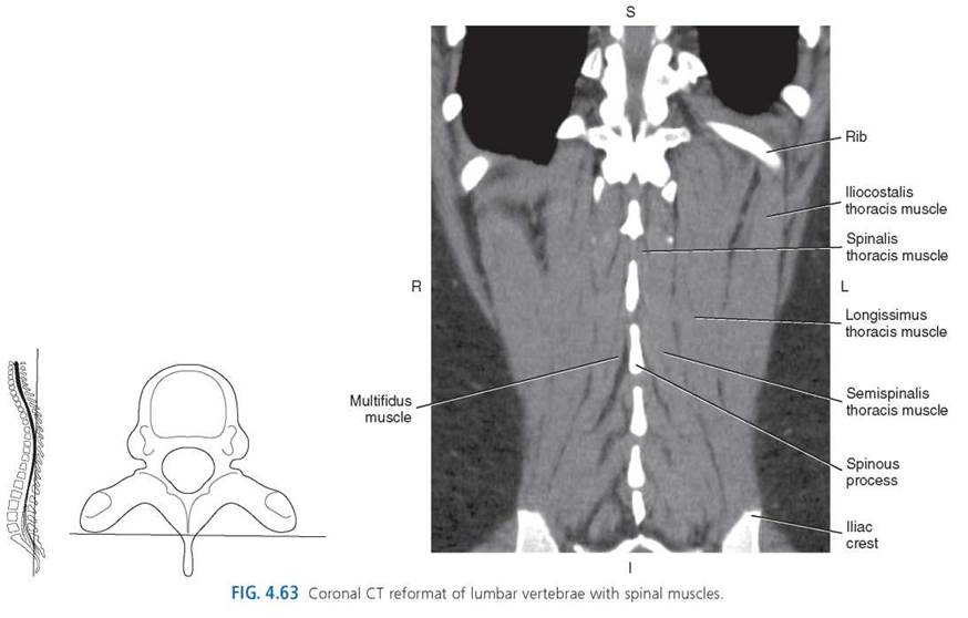 Spine - Sectional anatomy for imaging professionals, 4th edition