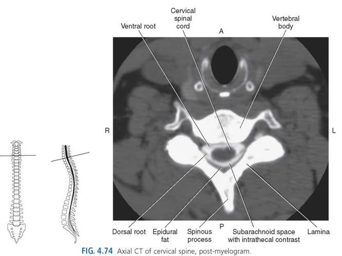 Spine - Sectional anatomy for imaging professionals, 4th edition