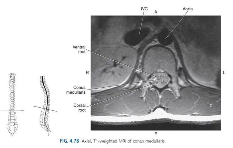 Spine - Sectional anatomy for imaging professionals, 4th edition