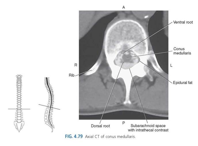 Spine - Sectional anatomy for imaging professionals, 4th edition