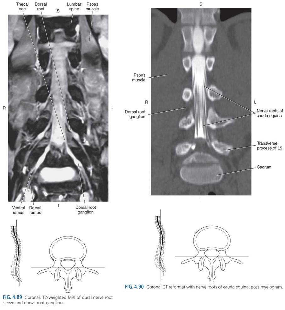 Spine - Sectional anatomy for imaging professionals, 4th edition