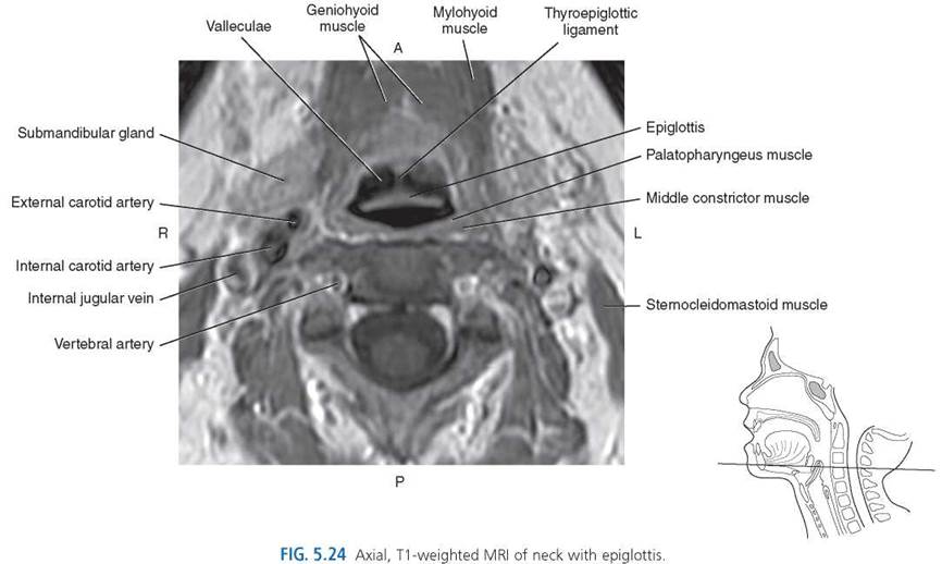 Neck - Sectional anatomy for imaging professionals, 4th edition