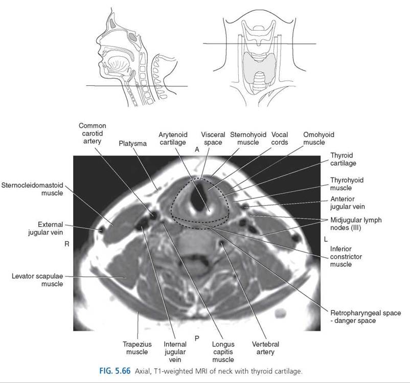 Neck - Sectional anatomy for imaging professionals, 4th edition