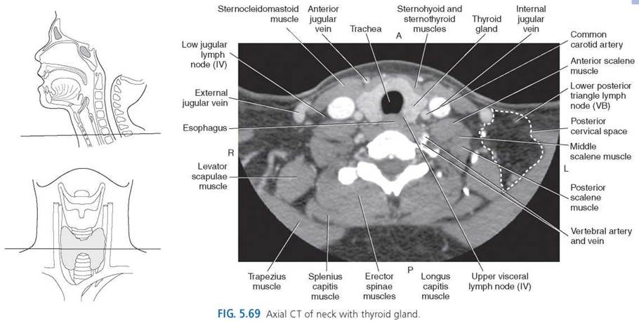 Neck - Sectional anatomy for imaging professionals, 4th edition