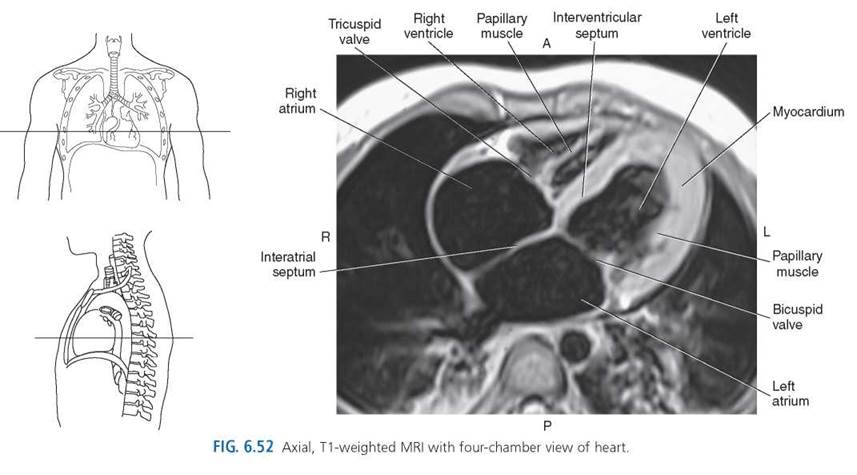 Thorax - Sectional anatomy for imaging professionals, 4th edition