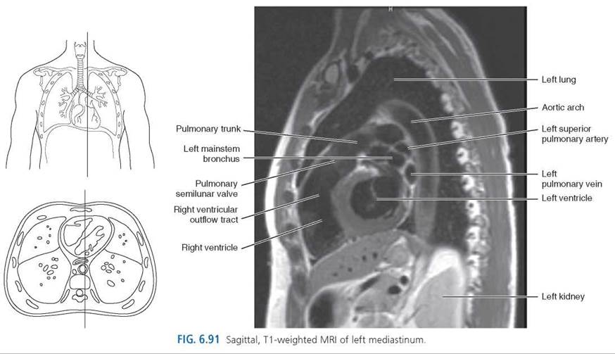 Thorax - Sectional anatomy for imaging professionals, 4th edition