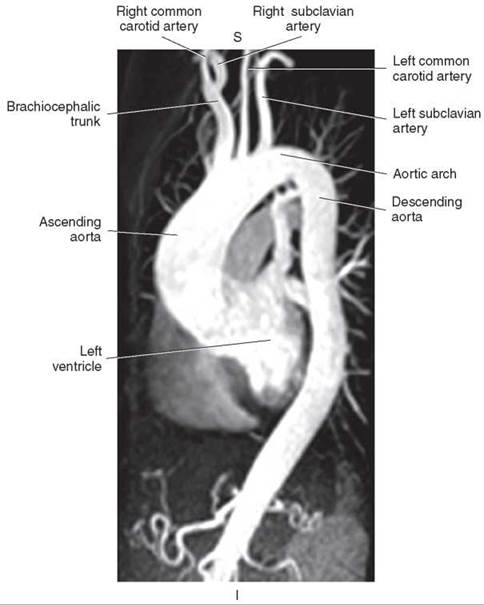 Thorax - Sectional anatomy for imaging professionals, 4th edition
