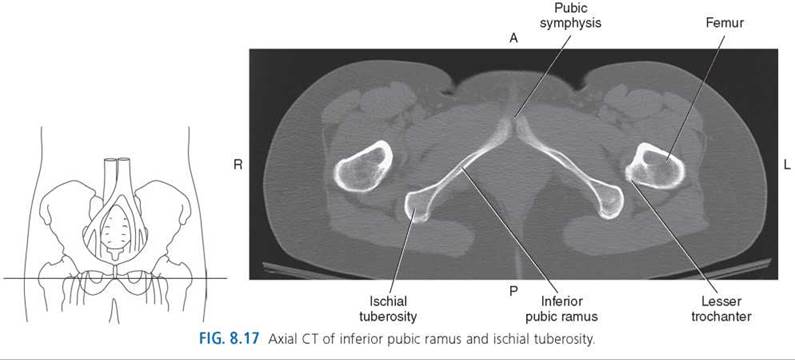 Pelvis - Sectional anatomy for imaging professionals, 4th edition