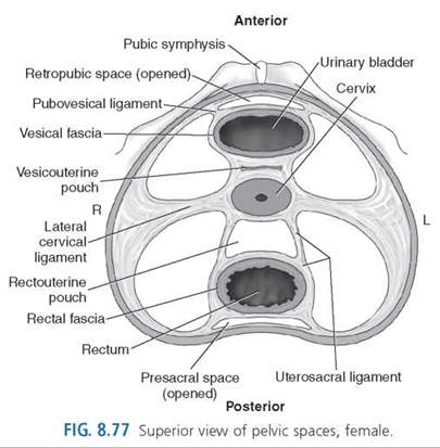 Pelvis - Sectional anatomy for imaging professionals, 4th edition