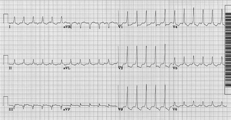 Electrocardiographic Interpretation - Cardiology Intensive Board Review ...