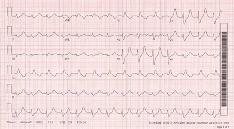 Electrocardiographic Interpretation - Cardiology Intensive Board Review ...