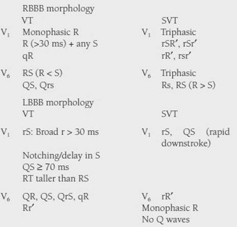 Wide-Complex Tachycardia: Ventricular Tachycardia versus ...