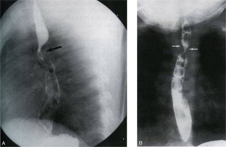 Abnormalities of the Aortic Arch - Echocardiography in Pediatric and ...