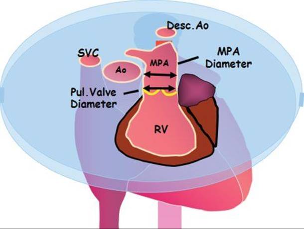 Fetal Echocardiography - Echocardiography in Pediatric and Adult Congenital Heart Disease, 2nd Ed.