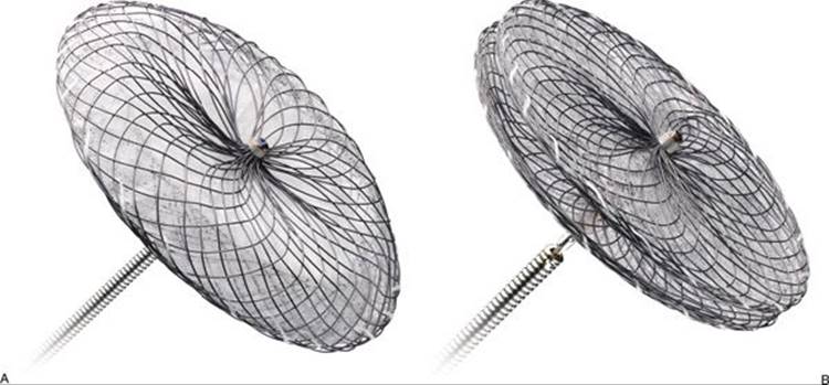Interventional Echocardiography in Congenital Heart Disease ...