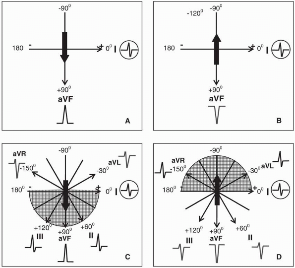 The Electrical Axis and Cardiac Rotation - Basic and Bedside ...