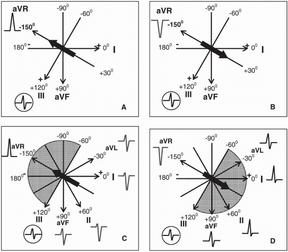 The Electrical Axis and Cardiac Rotation - Basic and Bedside ...