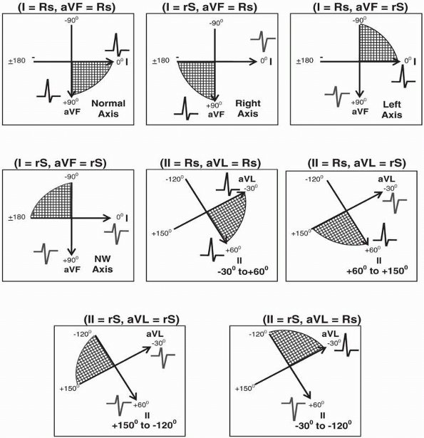 The Electrical Axis and Cardiac Rotation - Basic and Bedside ...