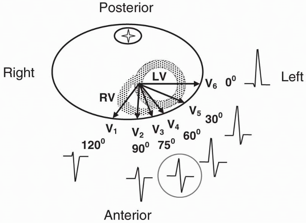 The Electrical Axis and Cardiac Rotation - Basic and Bedside ...