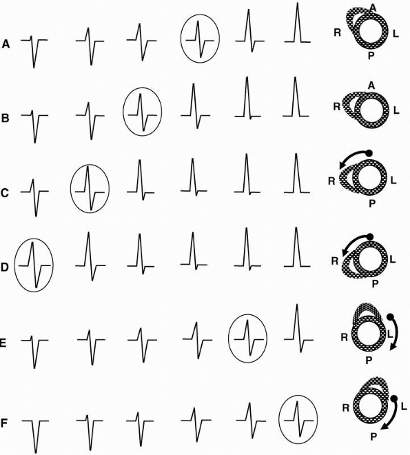 The Electrical Axis and Cardiac Rotation - Basic and Bedside ...