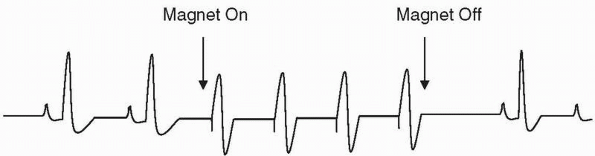 The ECG of Cardiac Pacemakers - Basic and Bedside Electrocardiography ...