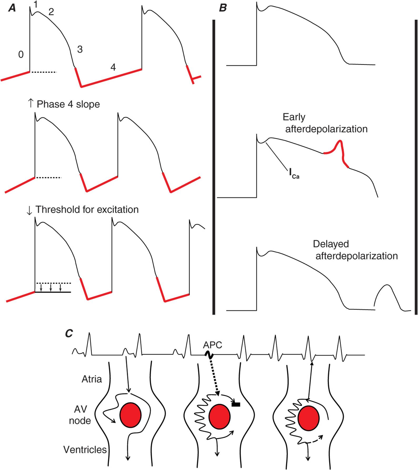 THE TACHYARRHYTHMIAS - HEART RHYTHM DISTURBANCES - Harrison's ...