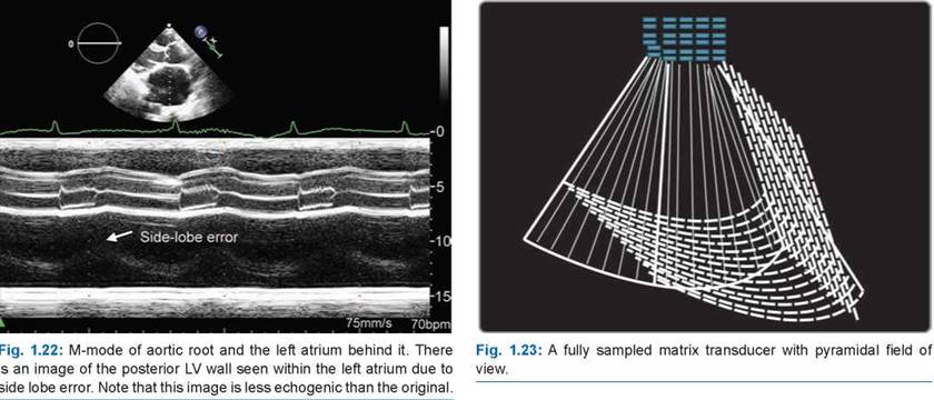 Echocardiography: Basic Principles, Technique, Display and ...
