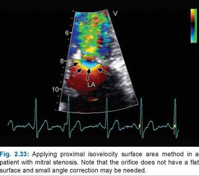 Hemodynamic Evaluation by Echo-Doppler Techniques - A Practical ...