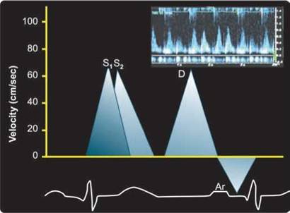 Diastolic Function - A Practical Approach to Clinical Echocardiography ...