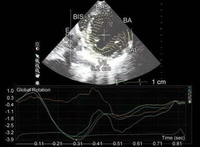 Rotation, Twist and Torsion - A Practical Approach to Clinical ...