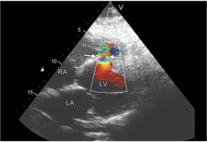 Congenital Heart Disease in Adults - A Practical Approach to Clinical ...