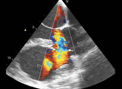Congenital Heart Disease in Adults - A Practical Approach to Clinical ...
