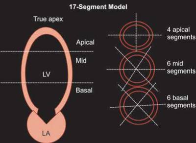 Ischemic Heart Disease - A Practical Approach to Clinical ...
