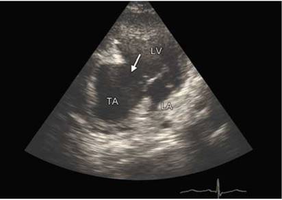 Ischemic Heart Disease - A Practical Approach to Clinical ...