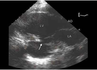 Ischemic Heart Disease - A Practical Approach to Clinical ...